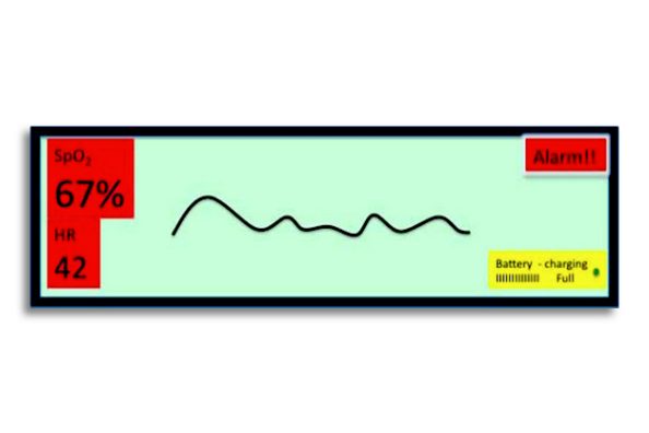 How to Use Pulse Oximeter During COVID-19 | Amazon Business